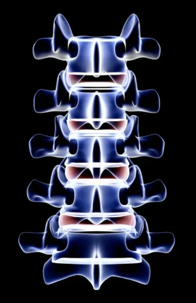 Artist Back Spine Bone Anatomy Spinal Stenosis Specialist In Dallas,