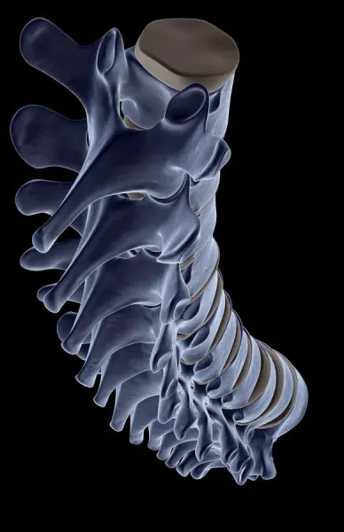 Artist Back Spine Bone Anatomy Spinal Stenosis Specialist In Dallas,